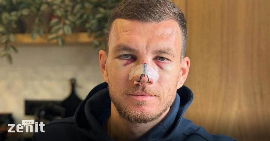 Barbarez: Džeko želi da igra sutra protiv Kipra, izgleda kao ratnik - Zenit.ba